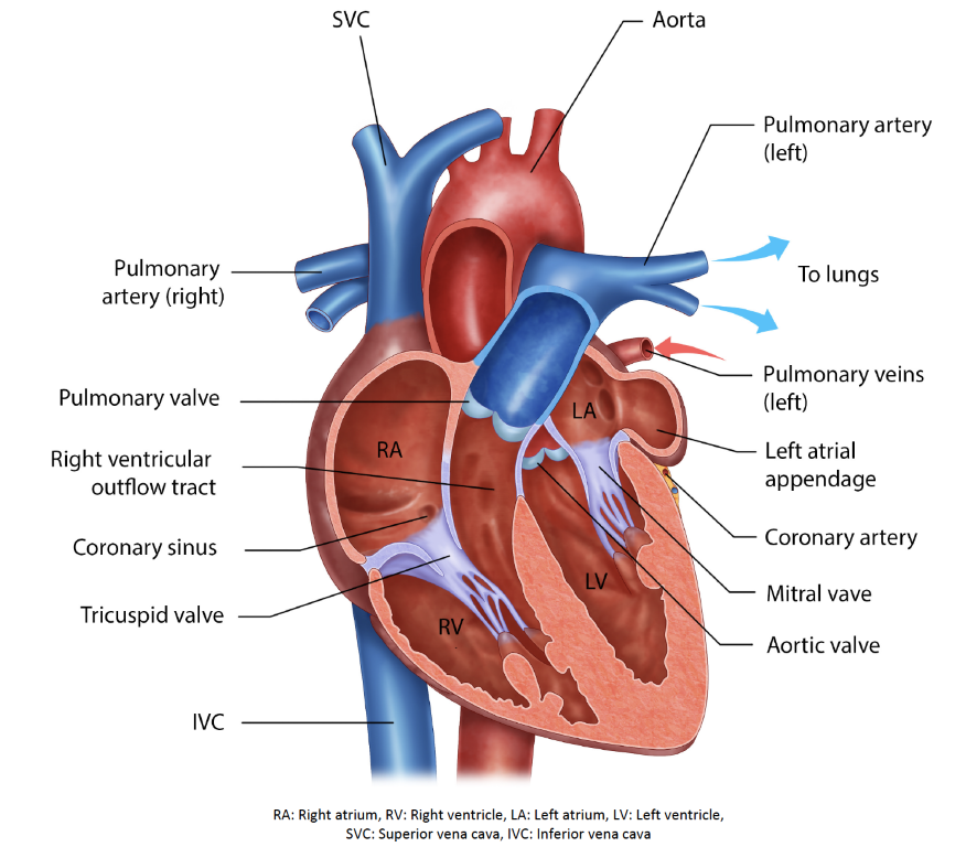 Valves Melbourne Heart Group Valves Melbourne Heart Group